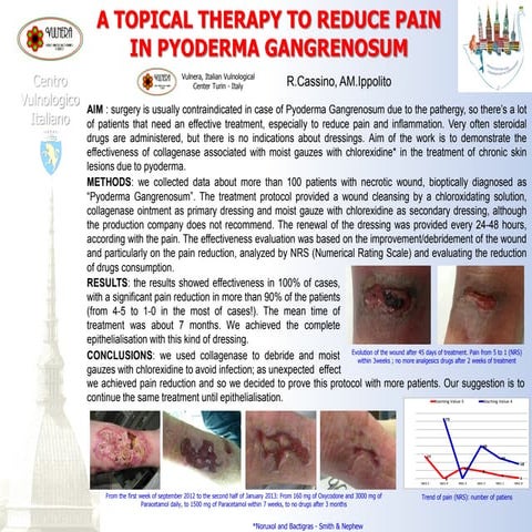 EWMA 2013 - Ep530 - A TOPICAL THERAPY TO REDUCE PAIN IN PYODERMA GANGRENOSUM | PDF