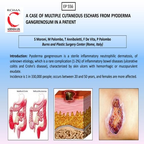 Hyaluronic acid | PPT