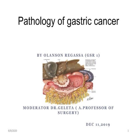 (E)pathology of gastric cancer | PPTX
