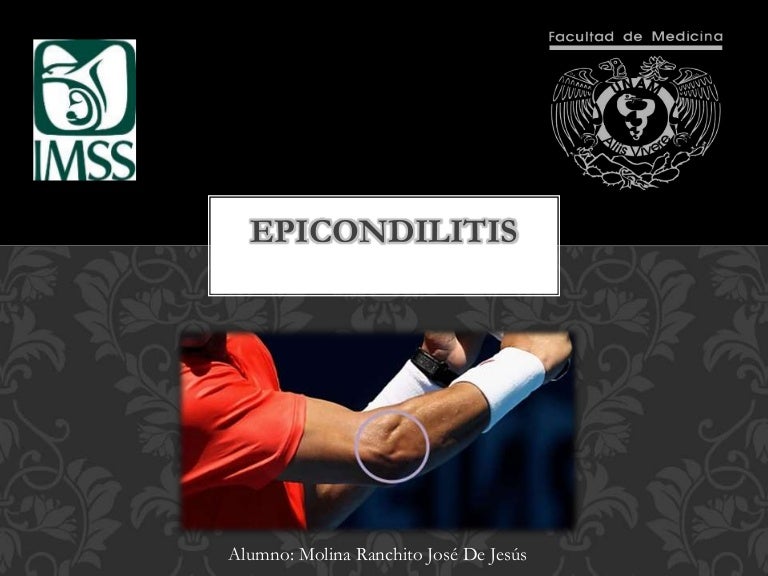 Epicondilitis y-epitrocleitis