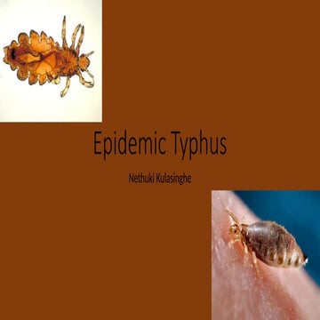 Presentation on the topic Epidemic Typhus | PPTX