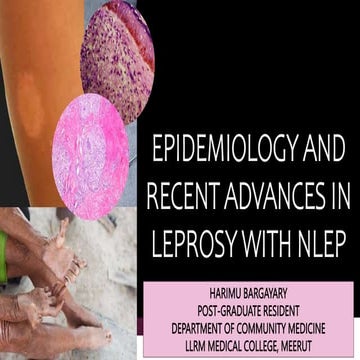EPIDEMIOLOGY AND RECENT ADVANCES IN LEPROSY WITH NLEP - HARIMU.pptx