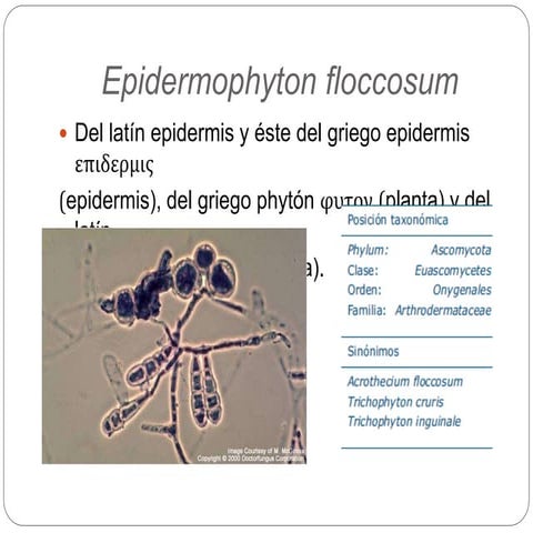 Epidermophyton floccosum | PPTX