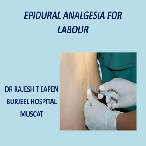 Epidural analgesia for labour | PDF
