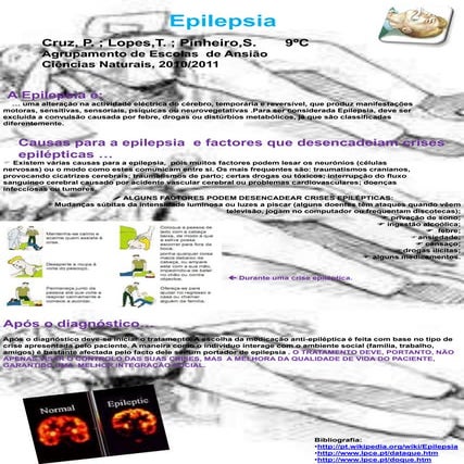 Epilepsia 2 | PPTX