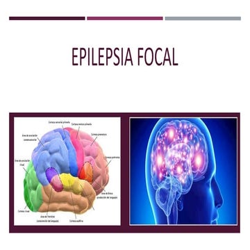 Diagrama Del Cerebro Con Epilepsia Establecen La Relación Entre Dos
