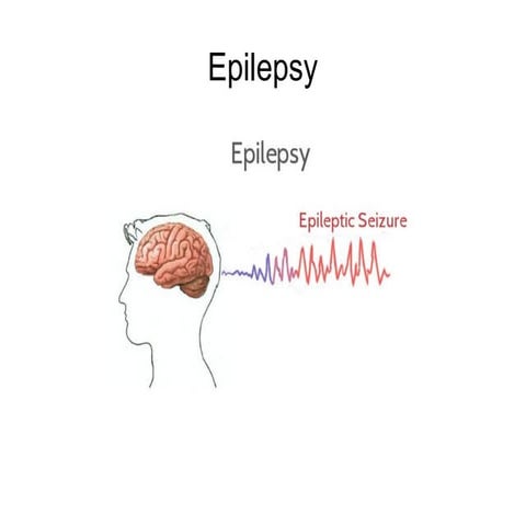 Epilepsy | PPT