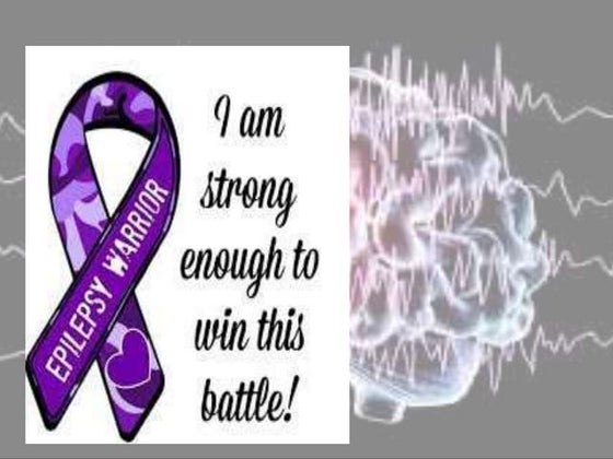 Epilepsy | PPT