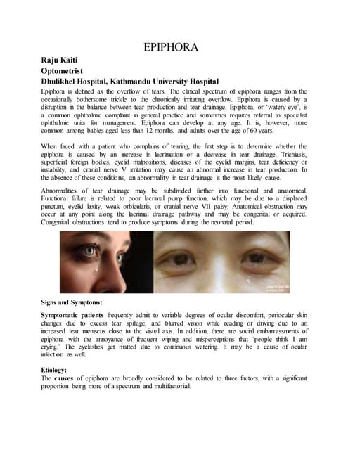 Examination of lacrimal system | PDF | Ear, Nose and Throat Conditions ...