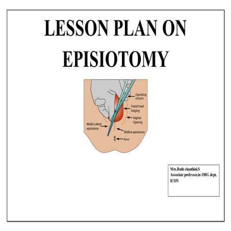 episiotomy. for micro teaching msc nur pdf | PDF