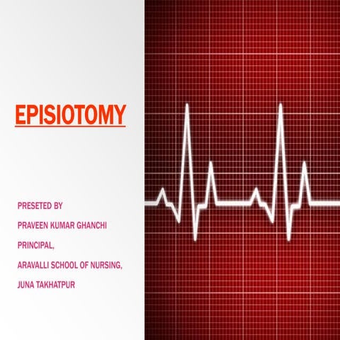 Episiotomy | PPTX