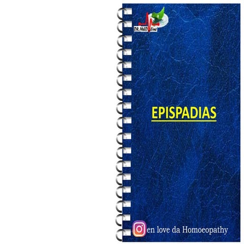 Epispadias by Dr.K.AmrithaAnilkumar | PPT