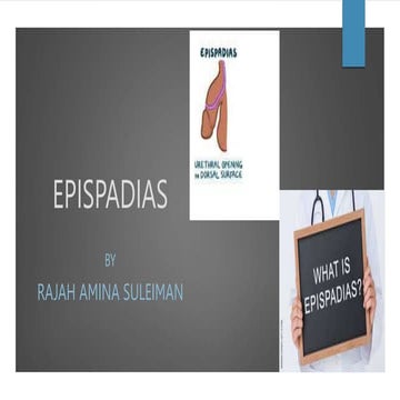 EPISPADIAS.pptx