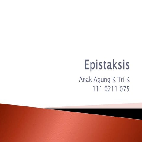Epistaksis | PPTX