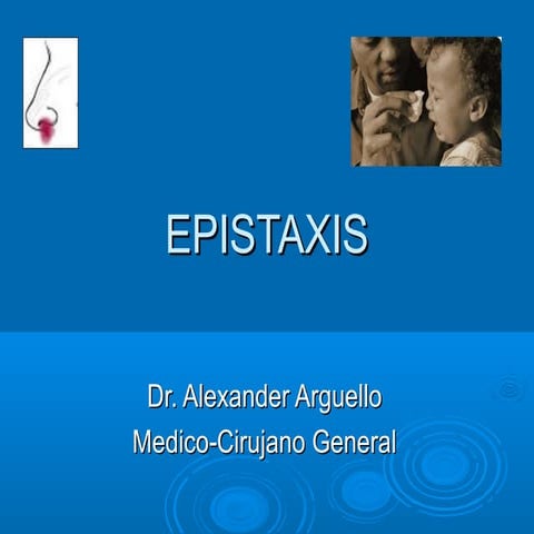 Epistaxis | PPT
