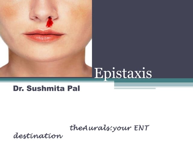 Epistaxis or Nose bleeding | PPT