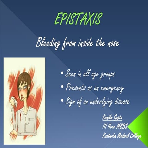 Epistaxis | PPT