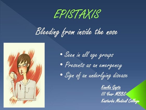 Epistaxis | PPT