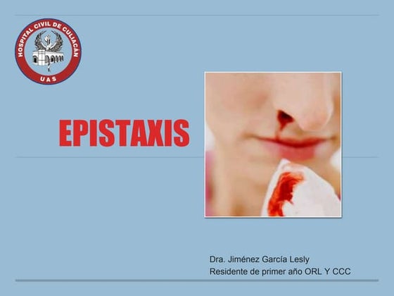 Epistaxis | PPT