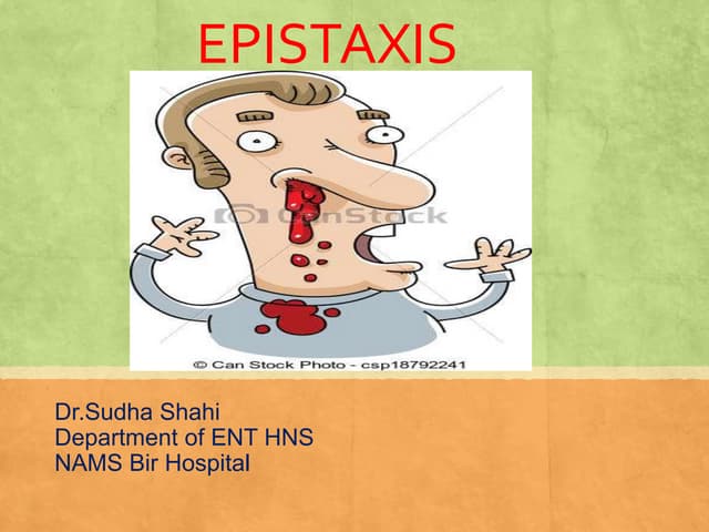 Epistaxis Pptx