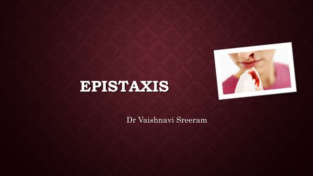 Epistaxis | PPT