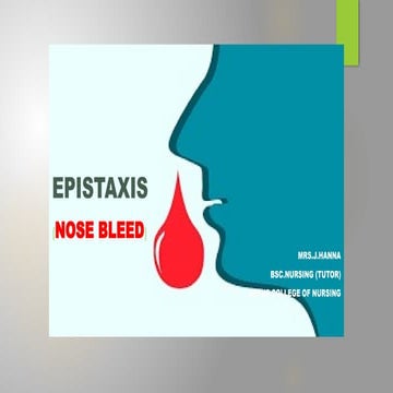 EPISTAXIS.pptx review of anatomy and pysioloy and start with ...