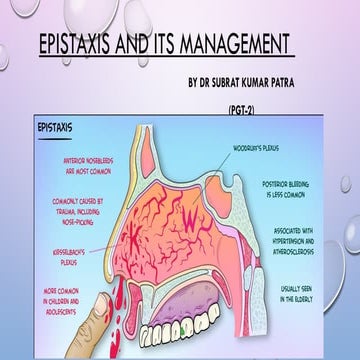 Epistaxis and its management.pptx details ent | PPT