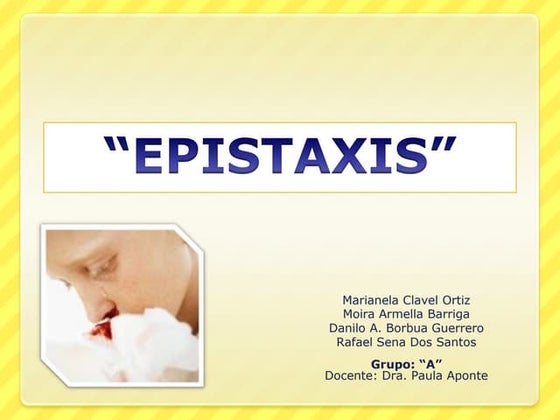 Epistaxis | PPT