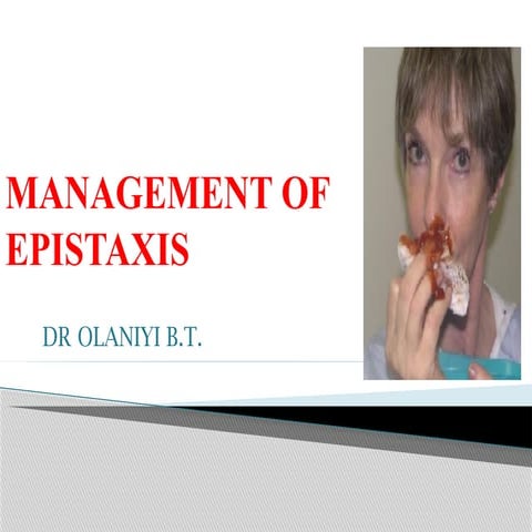 EPISTAXIS. EAR NOSE AND THROAT MEDICINE DR OLANIYI.pptx