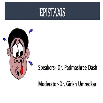EPISTAXIS | PPTX