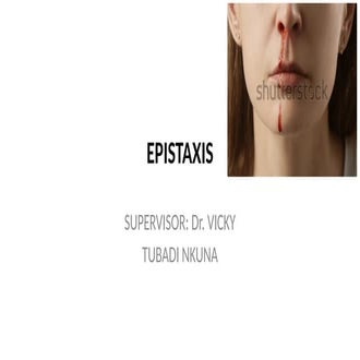 PLT Epistaxis.pptx