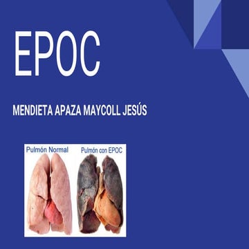 Epoc | PPTX