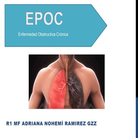 ERITROCITOSIS SECUNDARIA A EPOC Y SU IMPORTANCIA.pptx