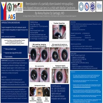 Principles of strabismus surgery part 2 of 3 | PDF
