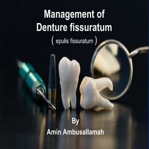 Management of Epulis fissuratum | PPTX