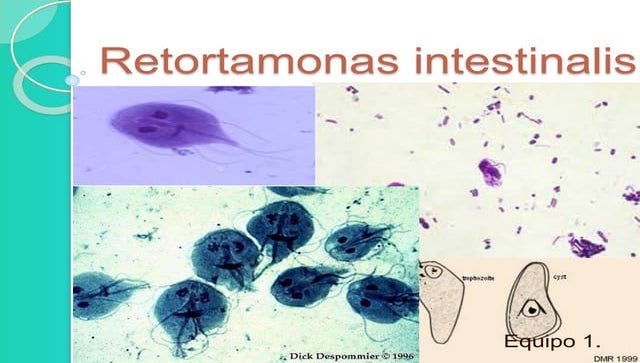 Retortamonas Intestinalis