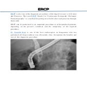 ERCP | PDF | Digestive Disorders | Diseases and Conditions
