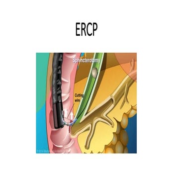 ERCP.pptx