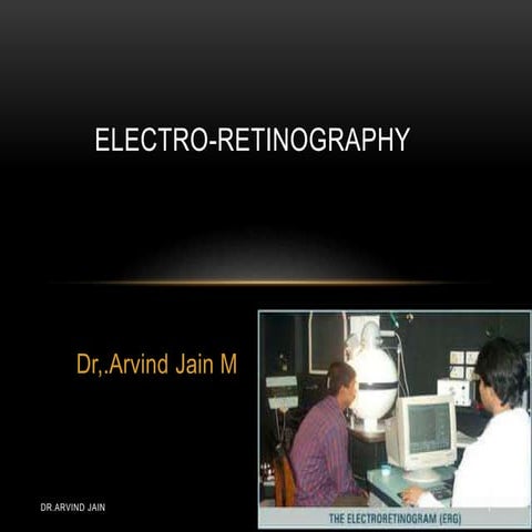 ELECTROOCULOGRAM (EOG) - Basics | PDF