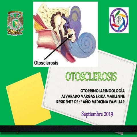 Eri otosclerosis | PPTX
