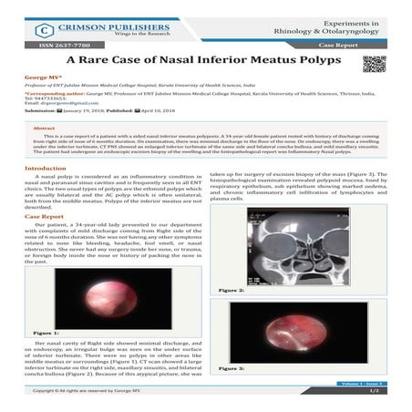Crimson publishers-A Rare Case of Nasal Inferior Meatus Polyps | PDF
