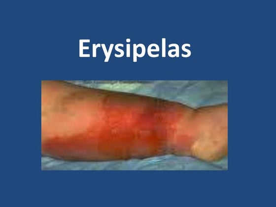 Erysipeloid | PPT