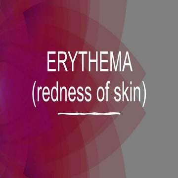 Erythema (redness of skin) | PPTX