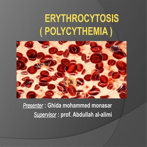 Erythrocytosis (Polycythemia),,Ghidaa.pptx