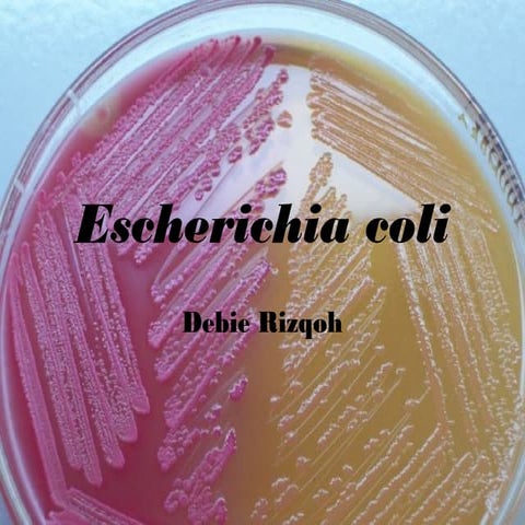 Escherichia_coli notes for Bacteriology 3rd year Bsc MLT | PPTX