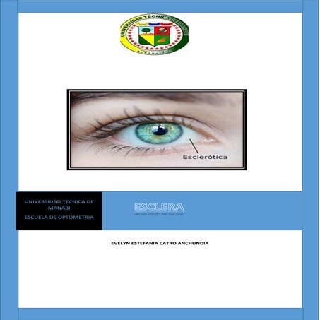 Esclera | PDF
