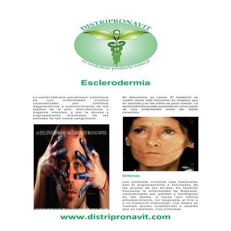 esclerodermia.pptx