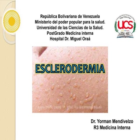 Esclerodermia..pptxdiagnostico y tratamiento | PPTX
