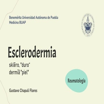 Esclerodermia - Reumatología (Med. Interna) | PPTX