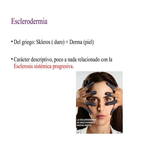 ESCLERODERMIA.pptx